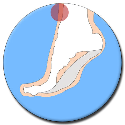 Shin Splints – Arch Supports – The Insole Store